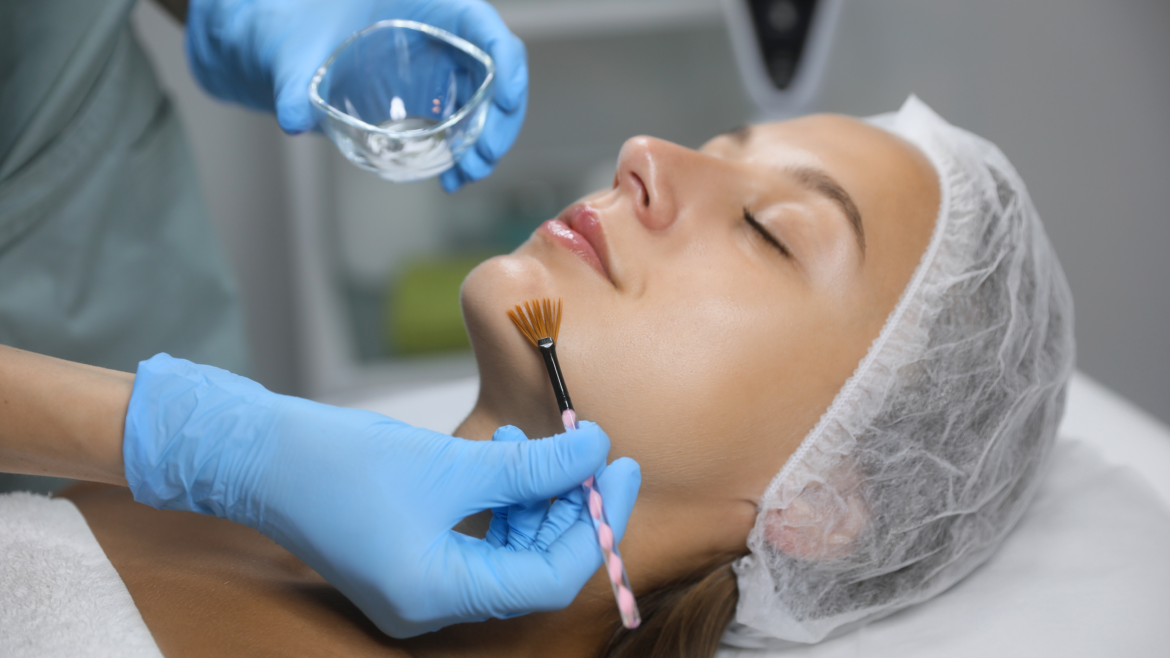 Peeling Facials – Lanaoncospa
